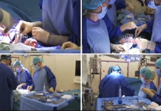 Santé : Service de néphrologie du CHU Batna : La 102 ème greffe rénale ...